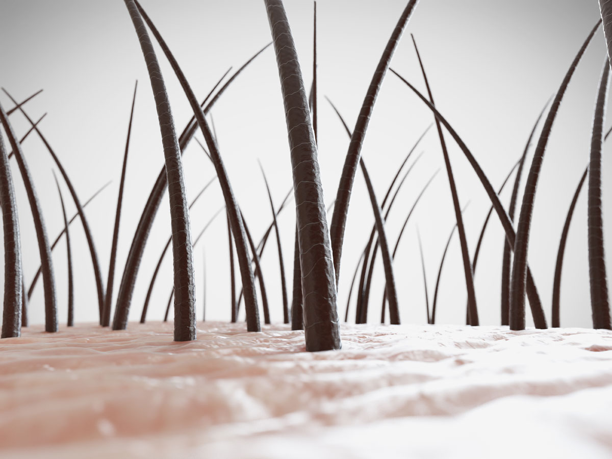 Le ghiandole sebacee | Cause eccesso di Sebo Sui Capelli