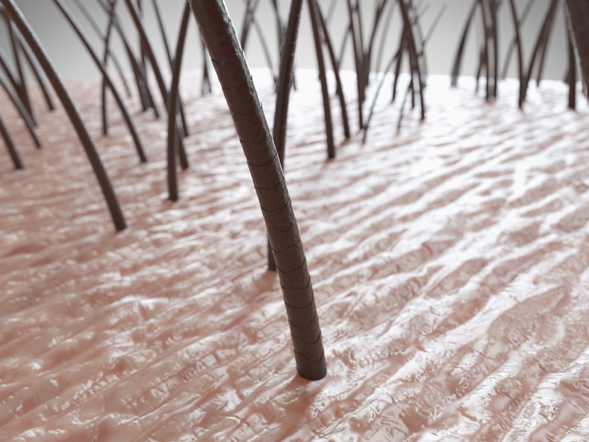 Le ghiandole sebacee | Cause eccesso di Sebo Sui Capelli