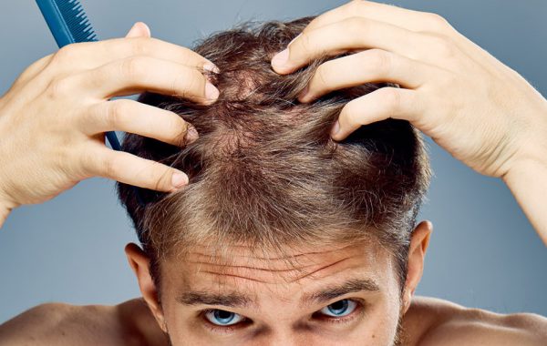 Il cuoio capelluto: la struttura - Istituto Helvetico Sanders