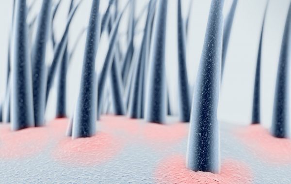 Nevralgia alla testa e dolori al cuoio capelluto, quali sono le cause?